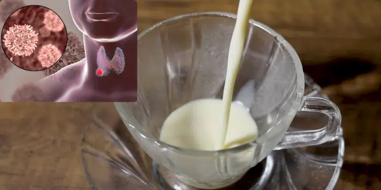 Think Green Juice Saves You? The Oxalate Bomb Inside That's Silently ...