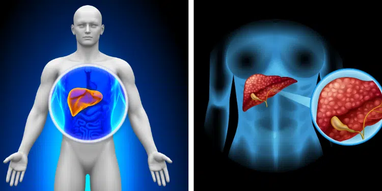 Why the Body Heals Better When You Support the Liver First